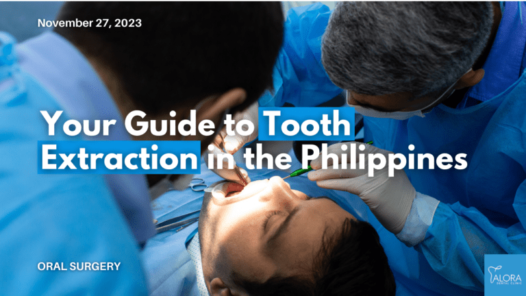 Ultimate Guide to Tooth Extraction in the Philippines
