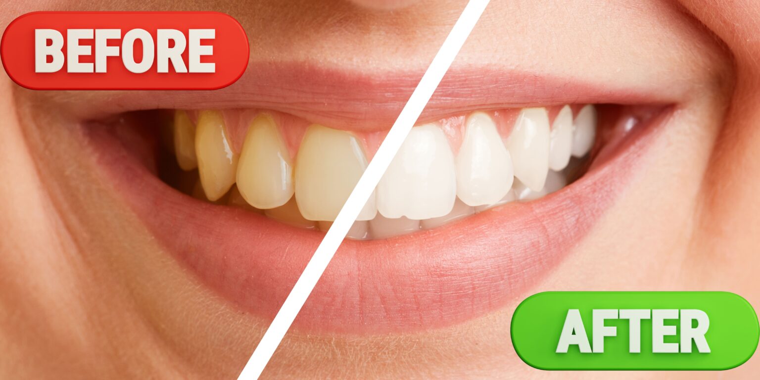 4 Common Brushing Mistakes and How to Fix Them
